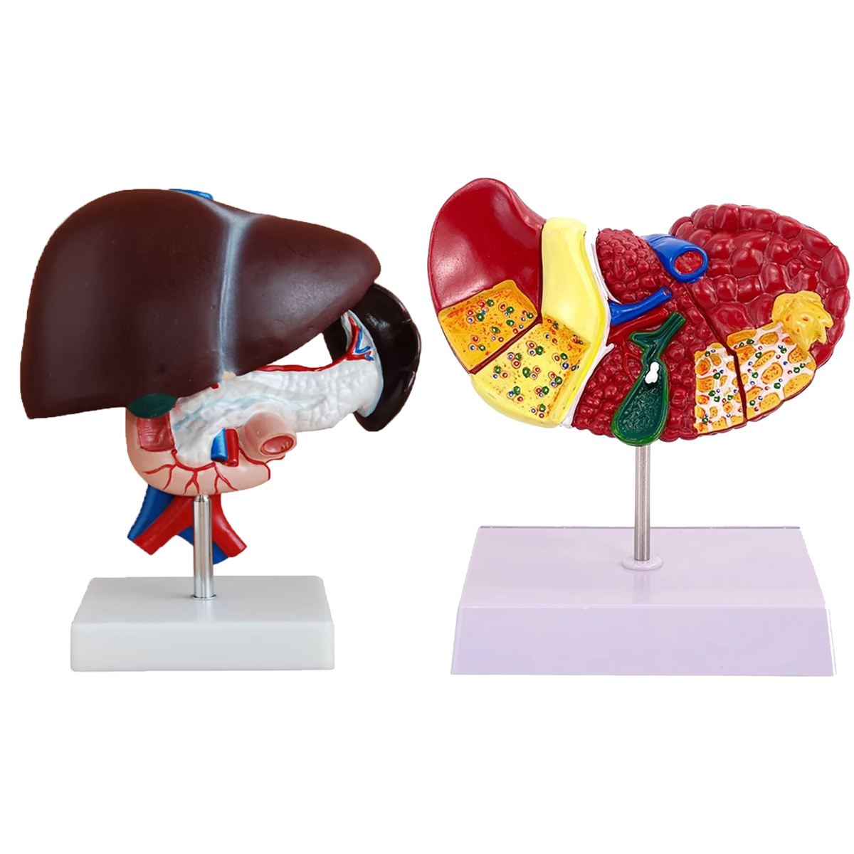 Liver Anatomy & Pathology Bundle - Myaskro